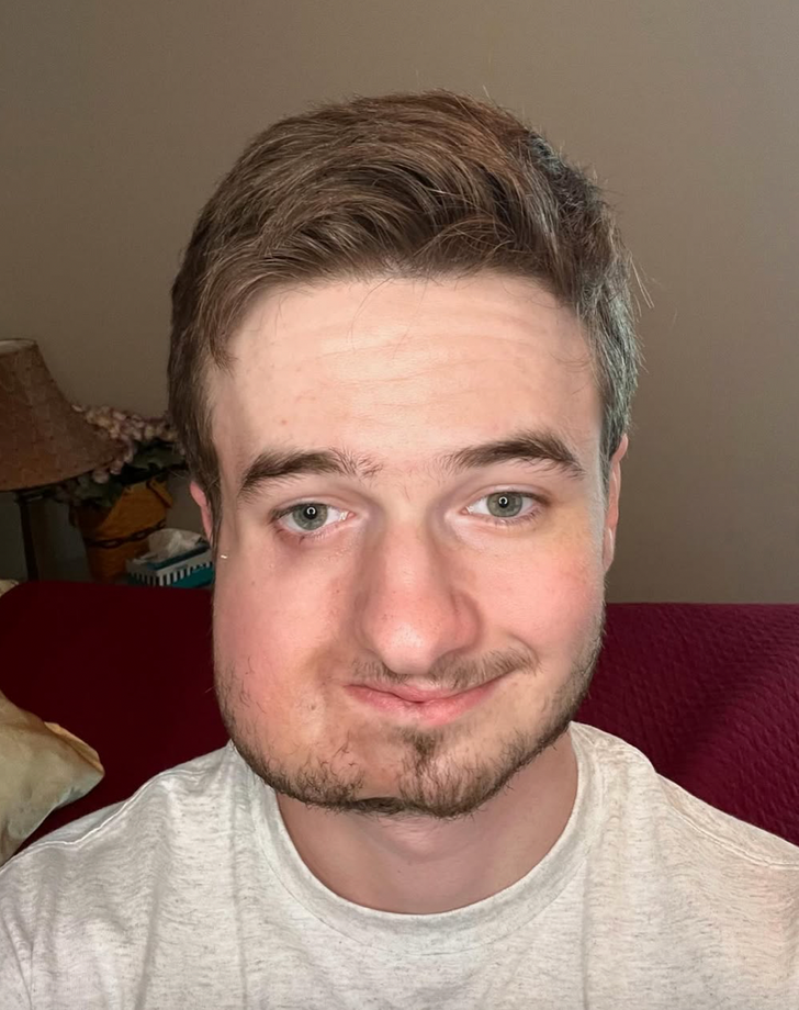 A Young Man’s Rare Condition Made Him an Unexpected Hero Online