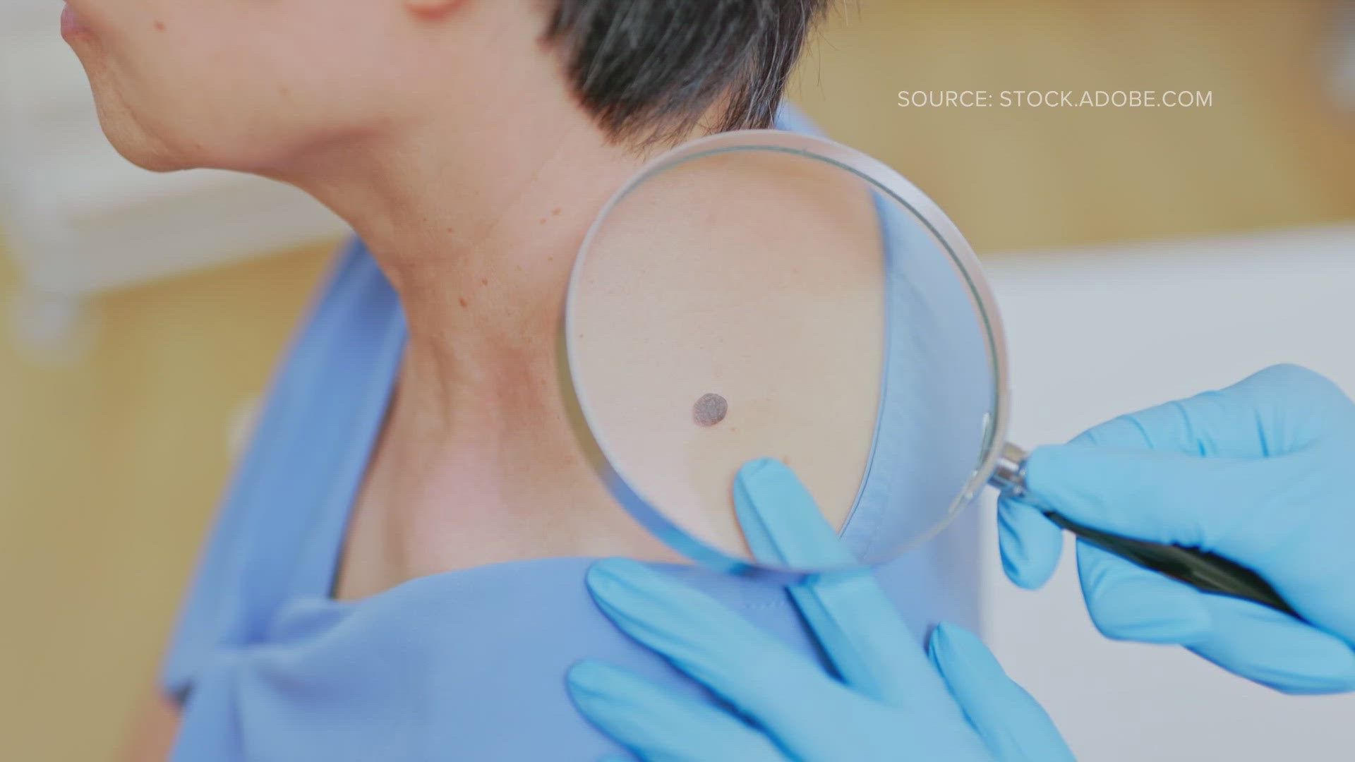 Local hospital offering free skin cancer screenings for firefighters