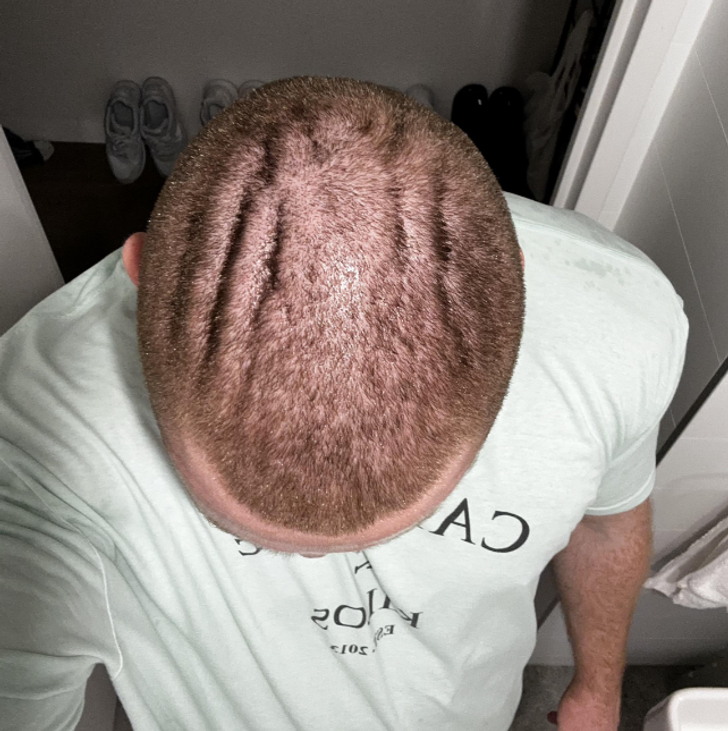 13 Times When Nature Gave People Unique Features