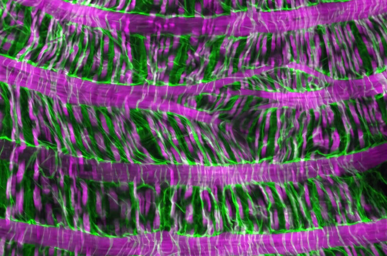 How tissues detect and repair damage to the body's hidden support system