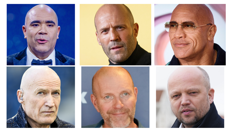 Kvinner er mer tiltrukket av skallede menn