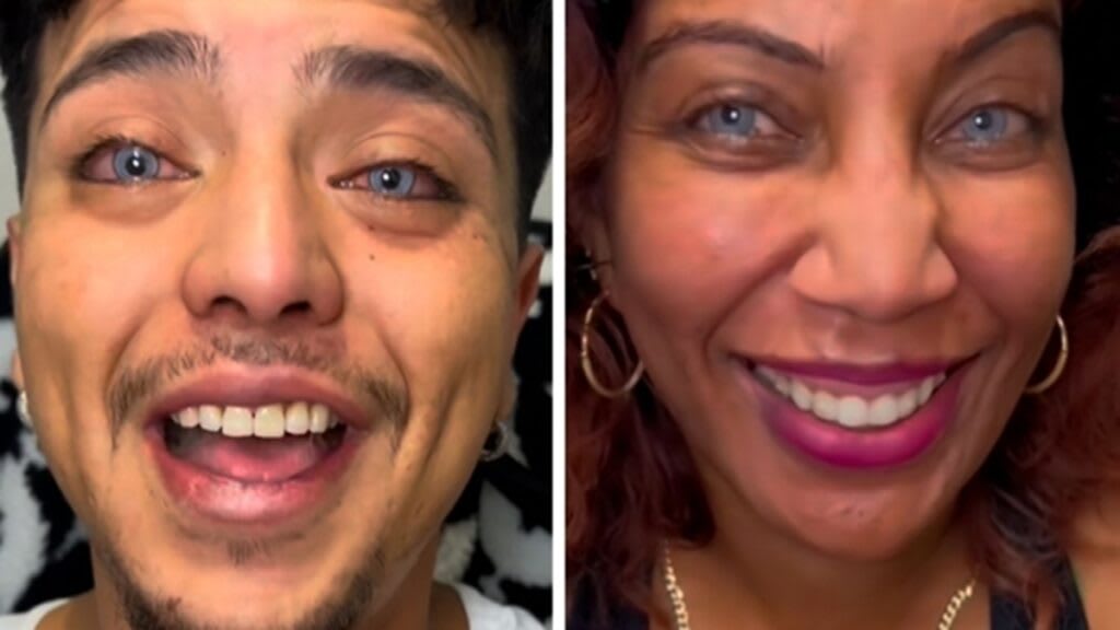 People Spend $12,000 to Tattoo Their Eyes and Change Their Color but ...