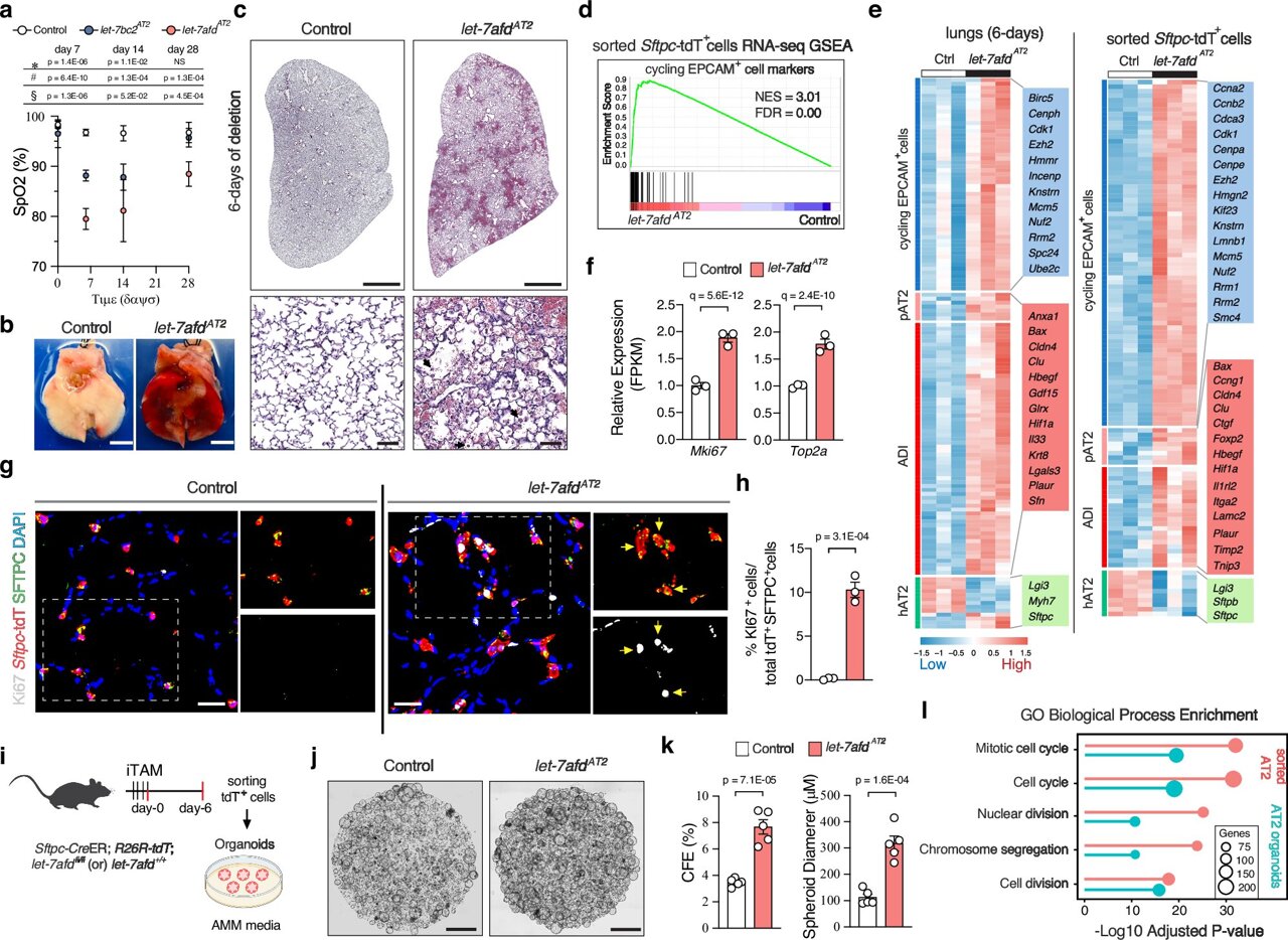 Let-7 gene is a key guardian of healthy lungs that keeps pulmonary ...