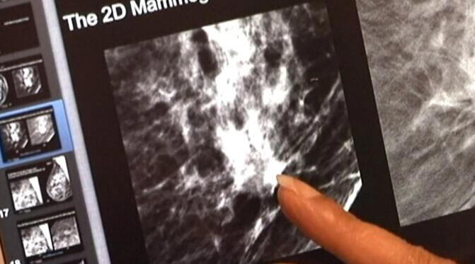 First non-compression mammography center opens in Middle Tennessee