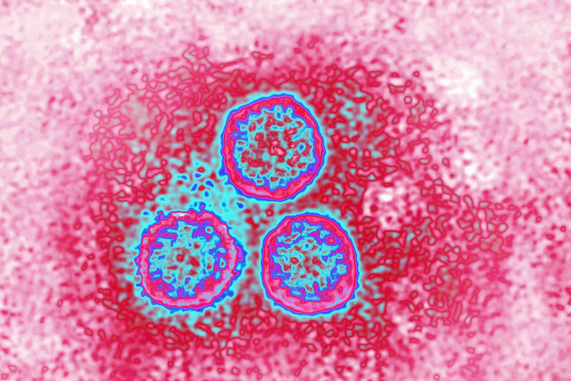 A new study found an increase in cancer cases under 50, most of them in ...