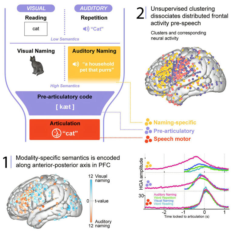 Mapping the brain's naming network: New insights into how people ...