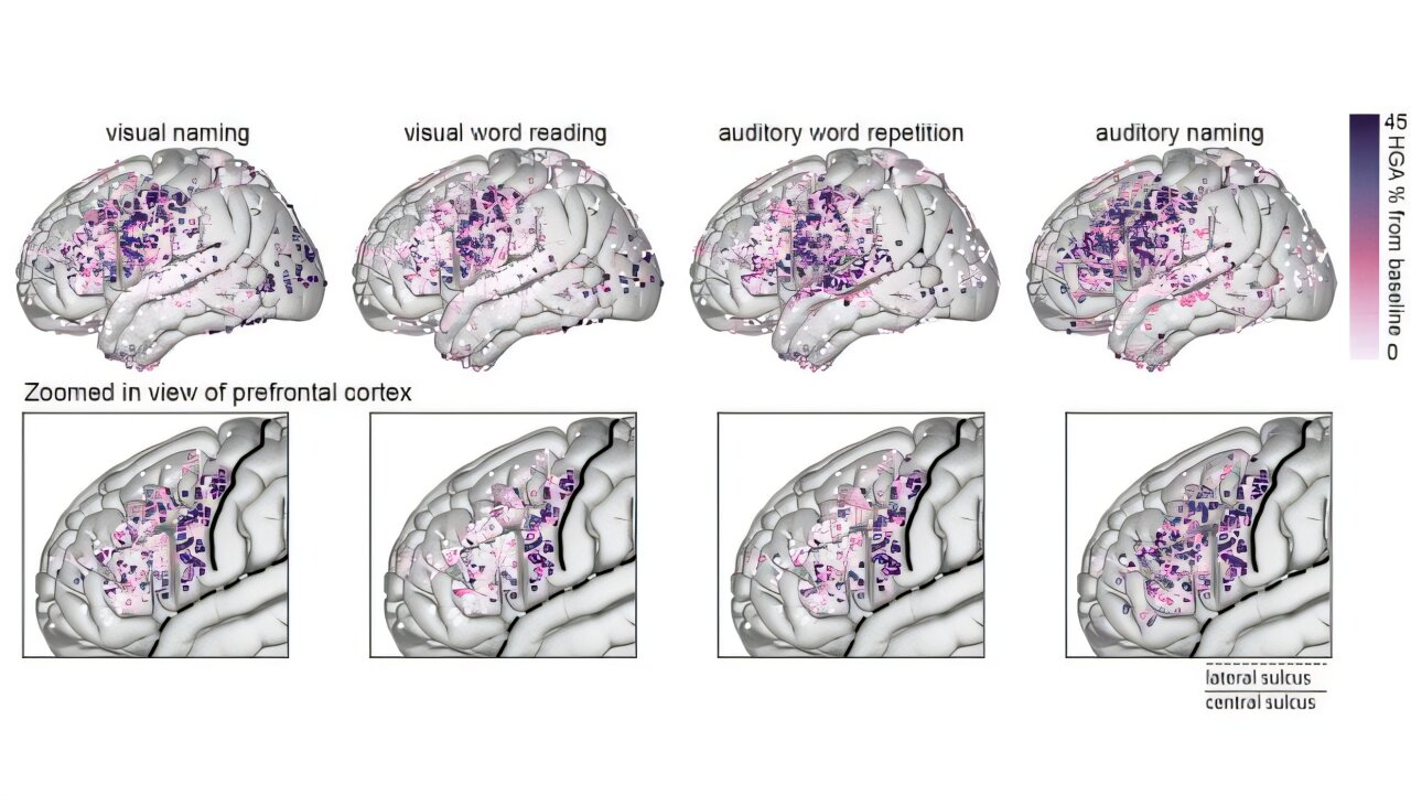 Mapping the brain's naming network: New insights into how people ...
