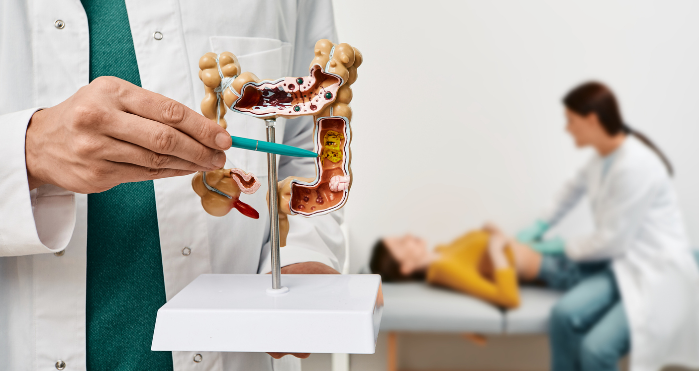 Doença de Crohn tem cura? Saiba sintomas e quando cirurgia é indicada