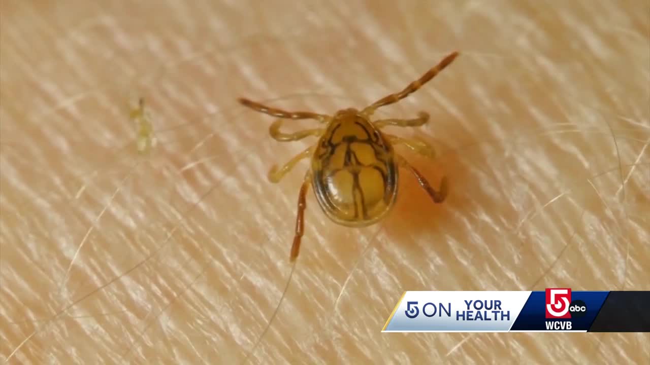 Doctor on a rise in tick bites in Massachusetts