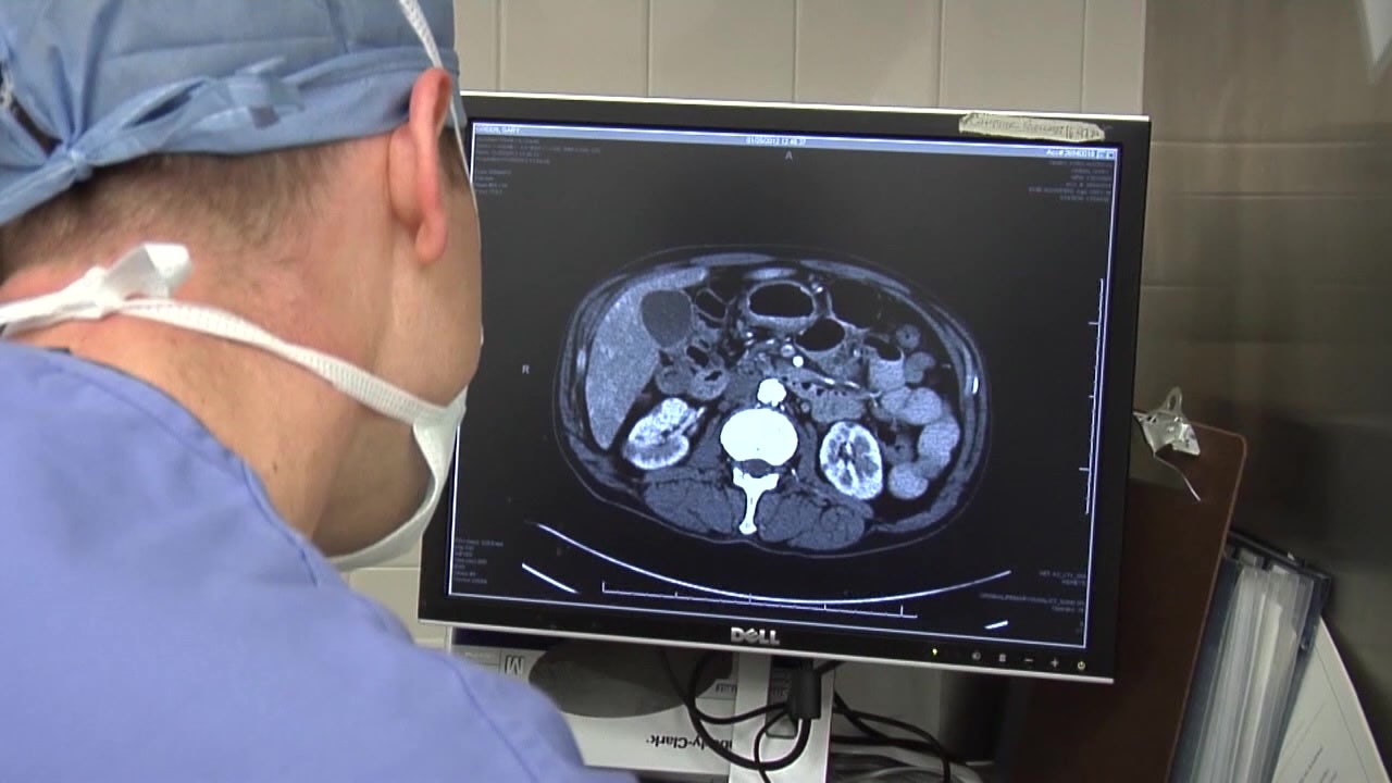 New glow in the dark technology, Cytalux, helping remove cancer cells