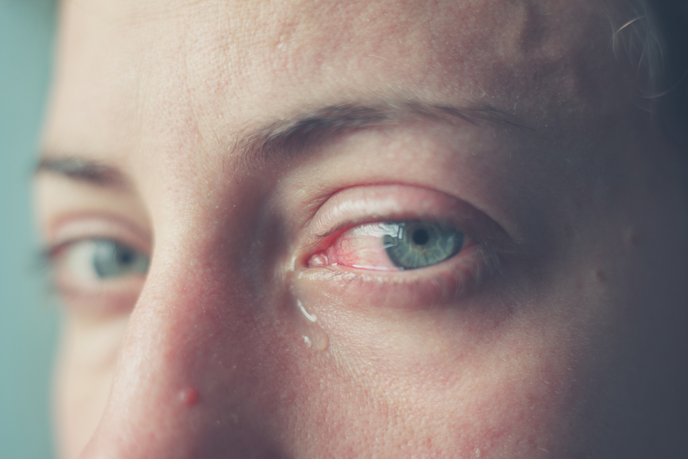 Got something stuck in your eye? Here’s how to remove it safely