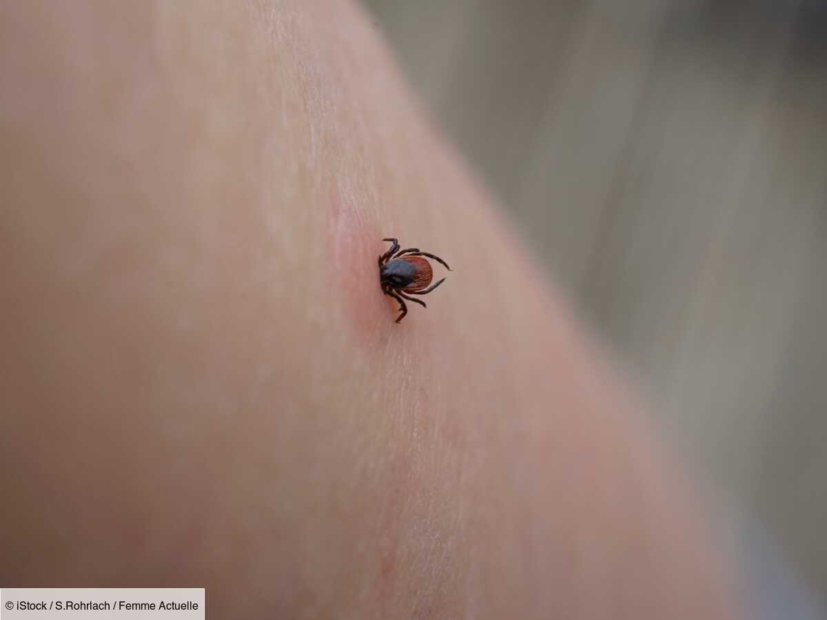 Piqué par une tique ? La seule technique efficace pour l'enlever ...