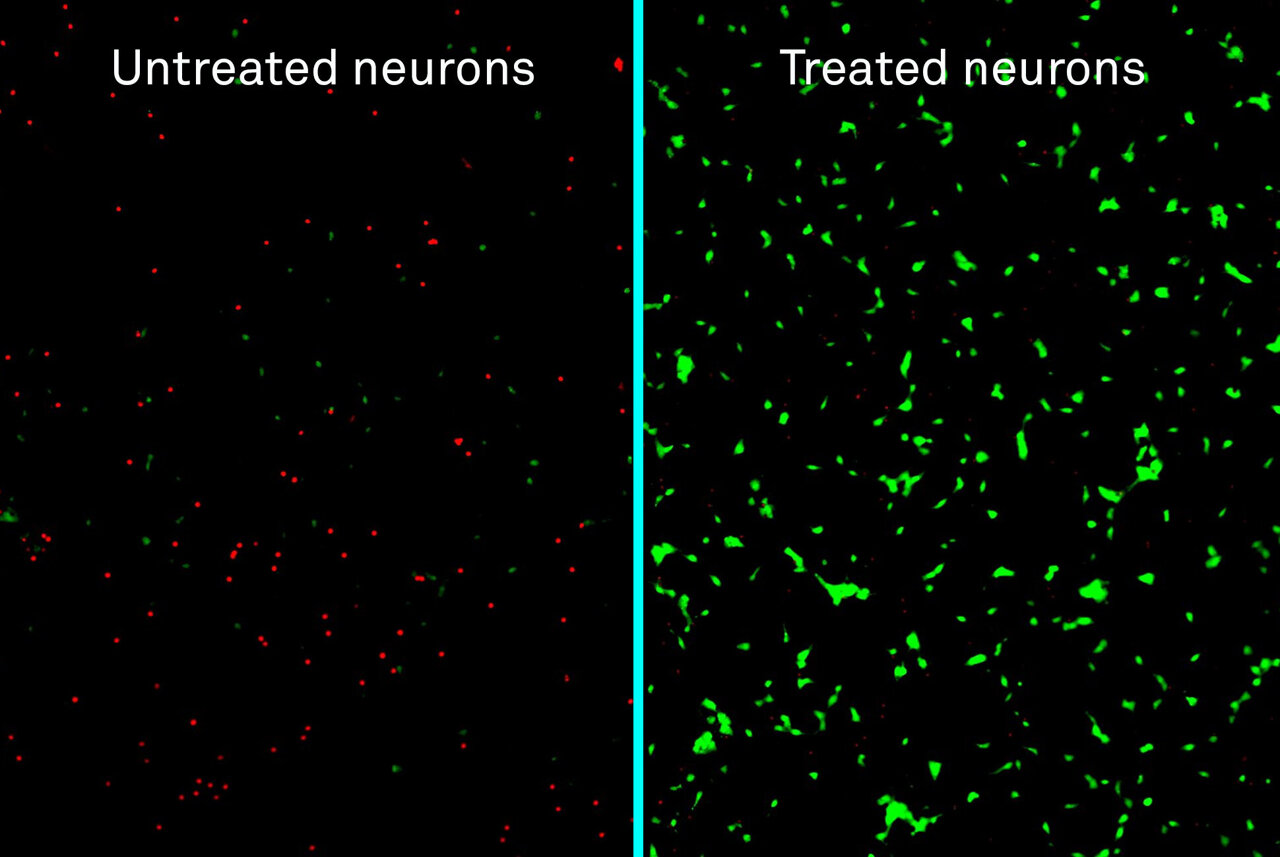 Sugar-coated nanotherapy dramatically improves neuron survival in ...