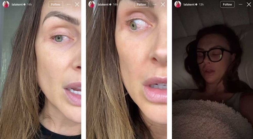 Lala Kent Shares a Health Update Months After Pre-Cancer Eye Diagnosis ...