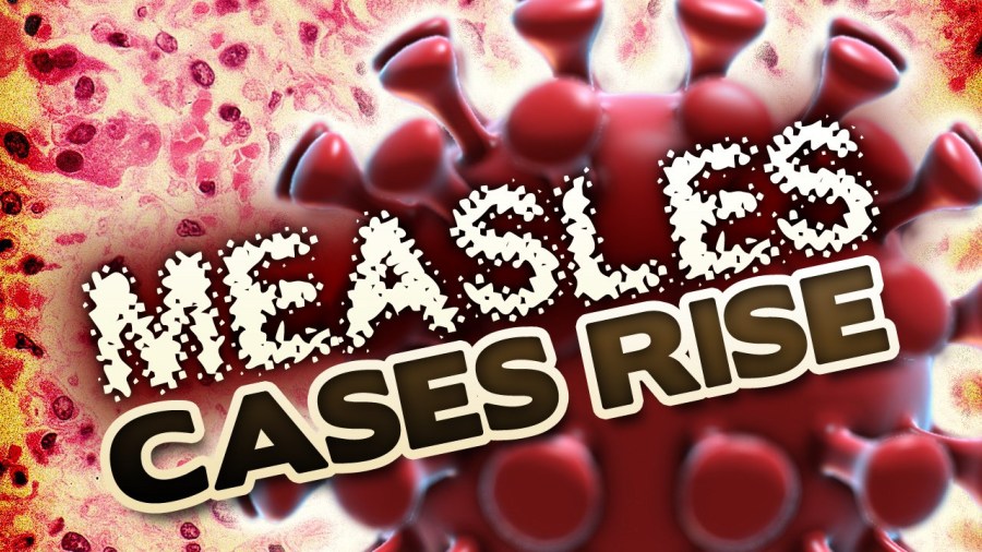 Measles spreads to Burke County, 28 cases in the state