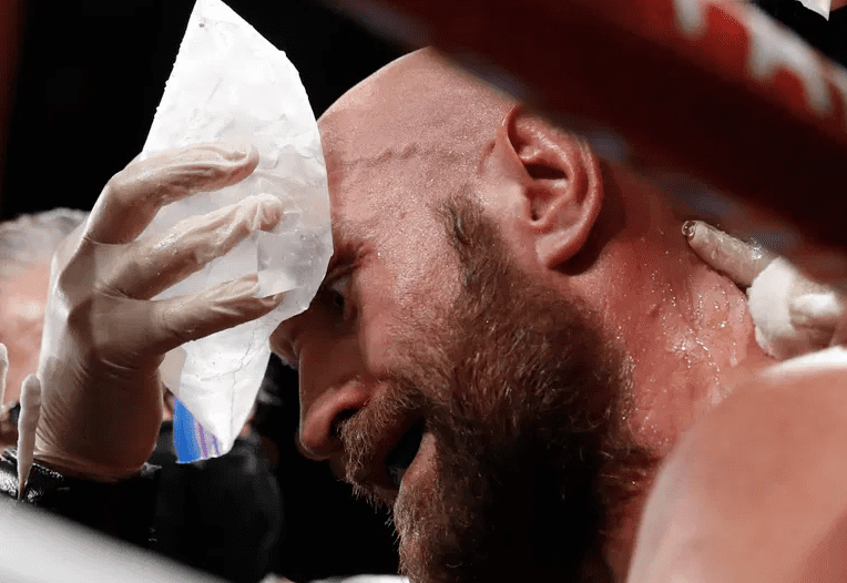 Fury Should Stay Retired - Here's Why