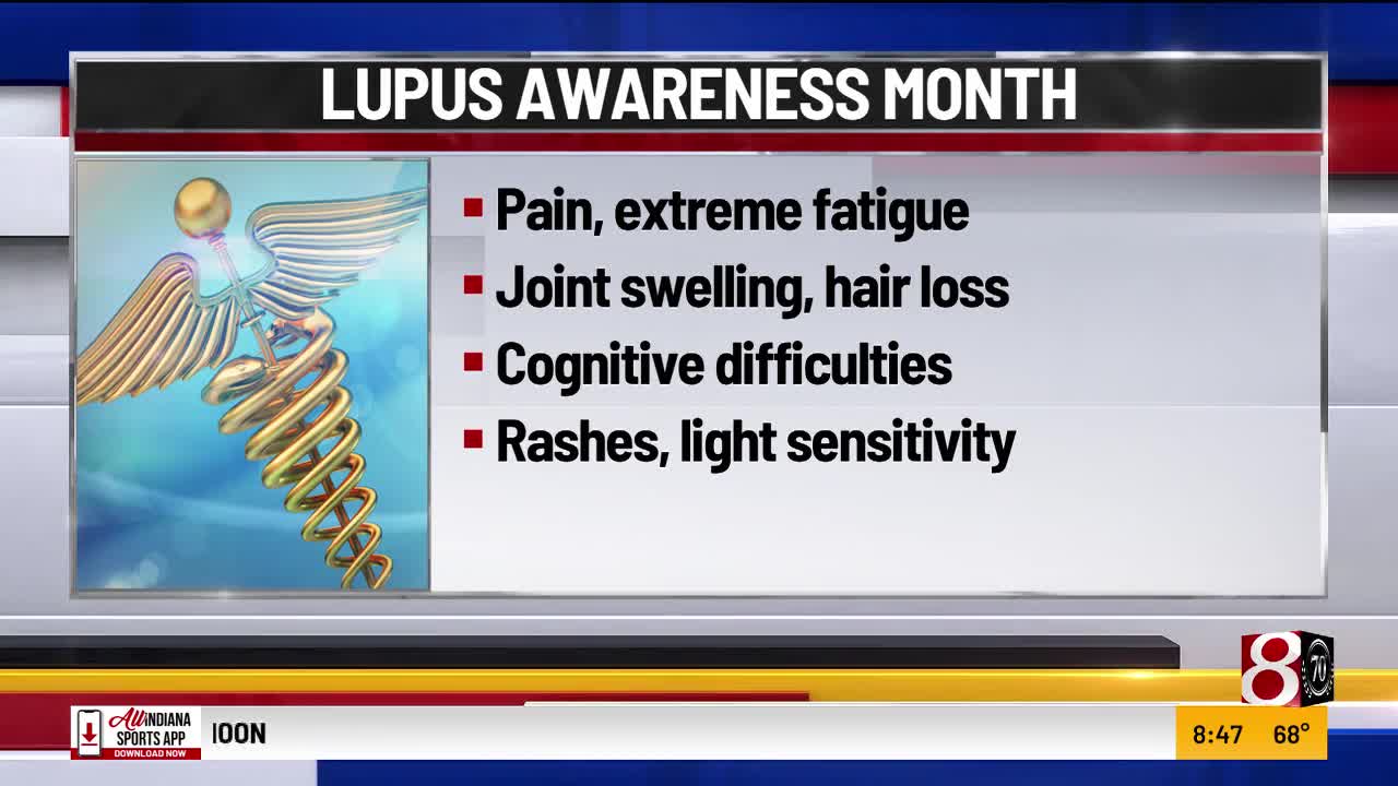 Morning Checkup: Understanding lupus