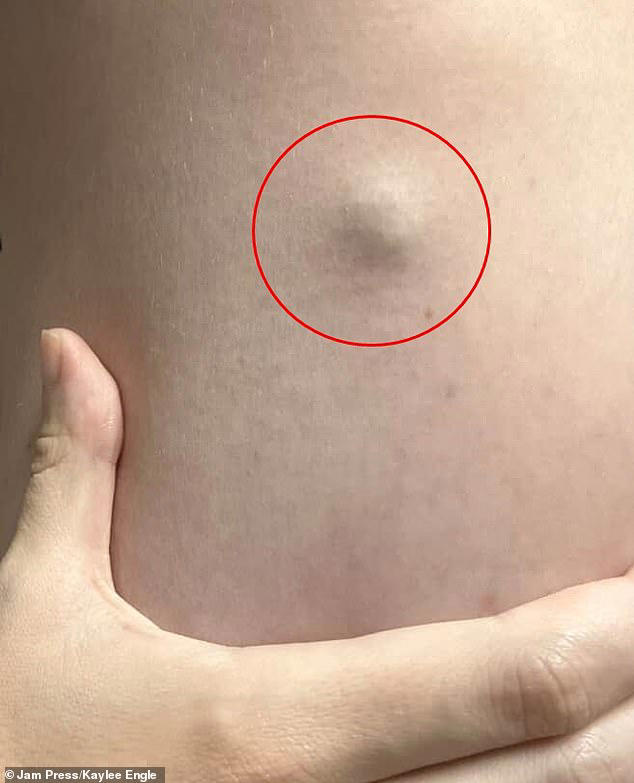 I was diagnosed with stage 4 cancer after strange things began ...