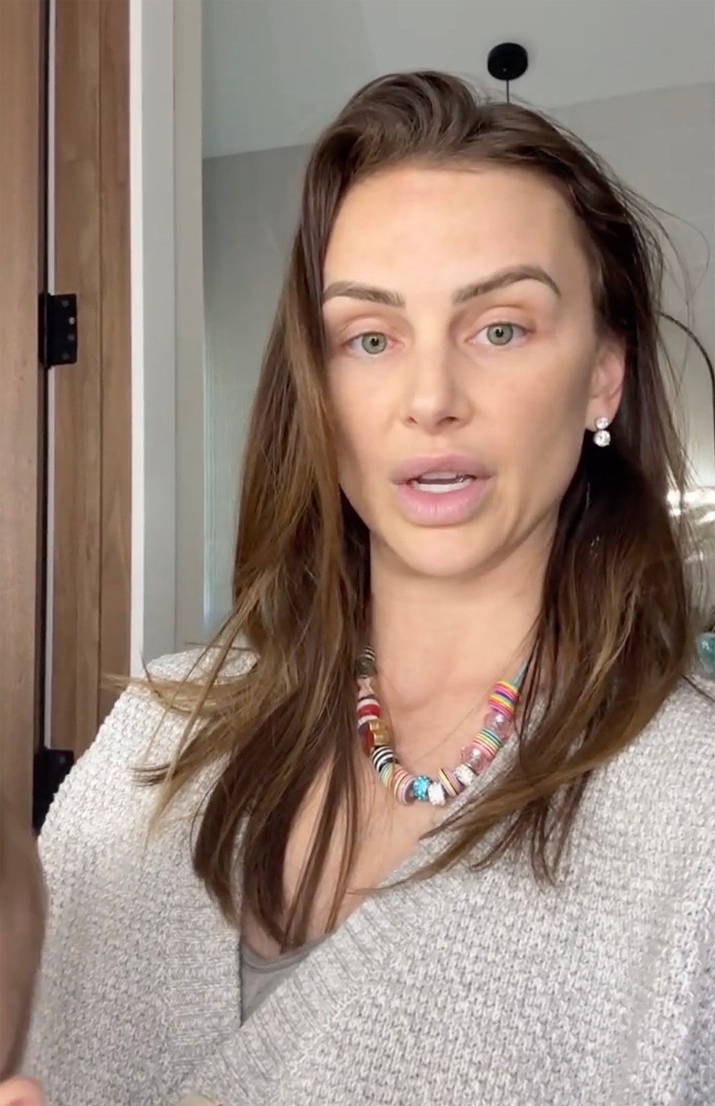Lala Kent reveals she has a ‘terrifying’ pre-cancerous eye abnormality