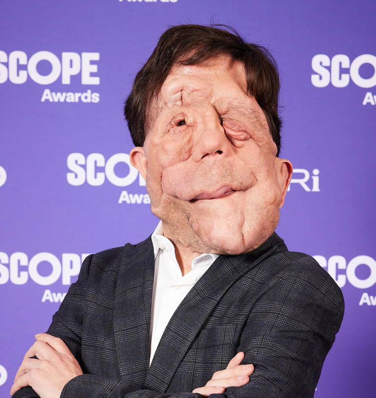 Chris McCausland hails how disabled people 'really are capable of so ...