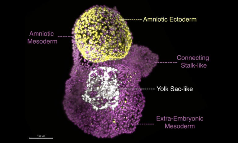 Stem cell model replicates human amniotic sac development past two weeks