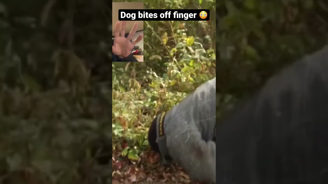 Dog nearly bites finger off during high-intensity training