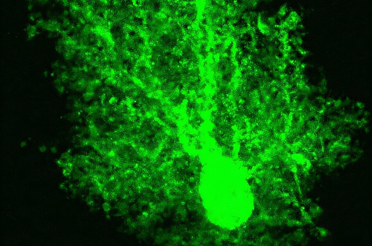 An overlooked cell type orchestrates brain rewiring during states of ...