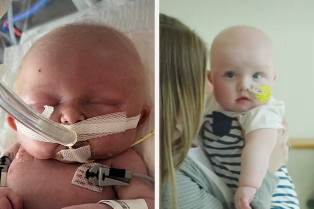 US baby with rare illness treated with tailor-made gene edit