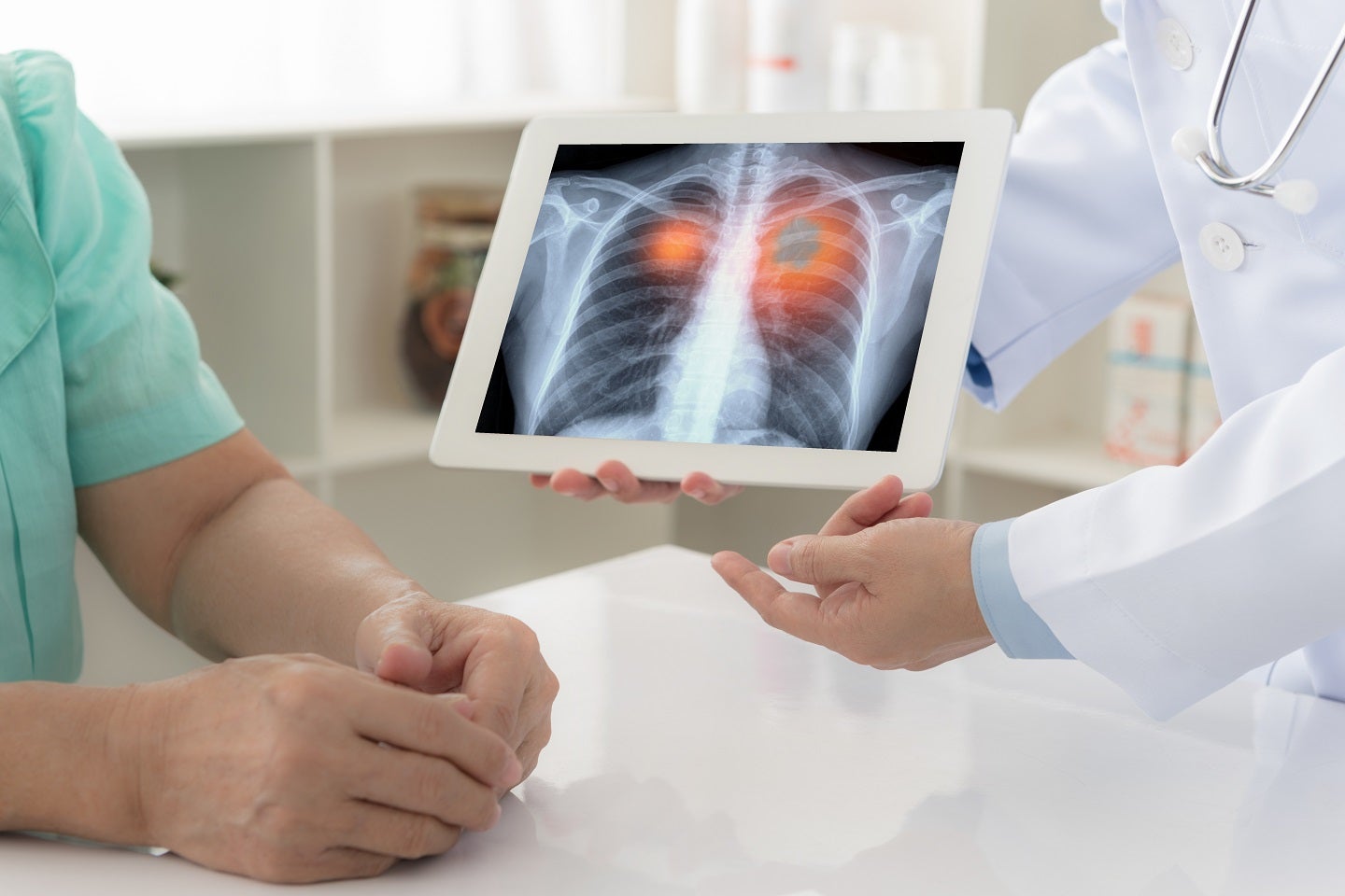 First subject dosed in Revolution Medicines’ Phase III NSCLC treatment ...