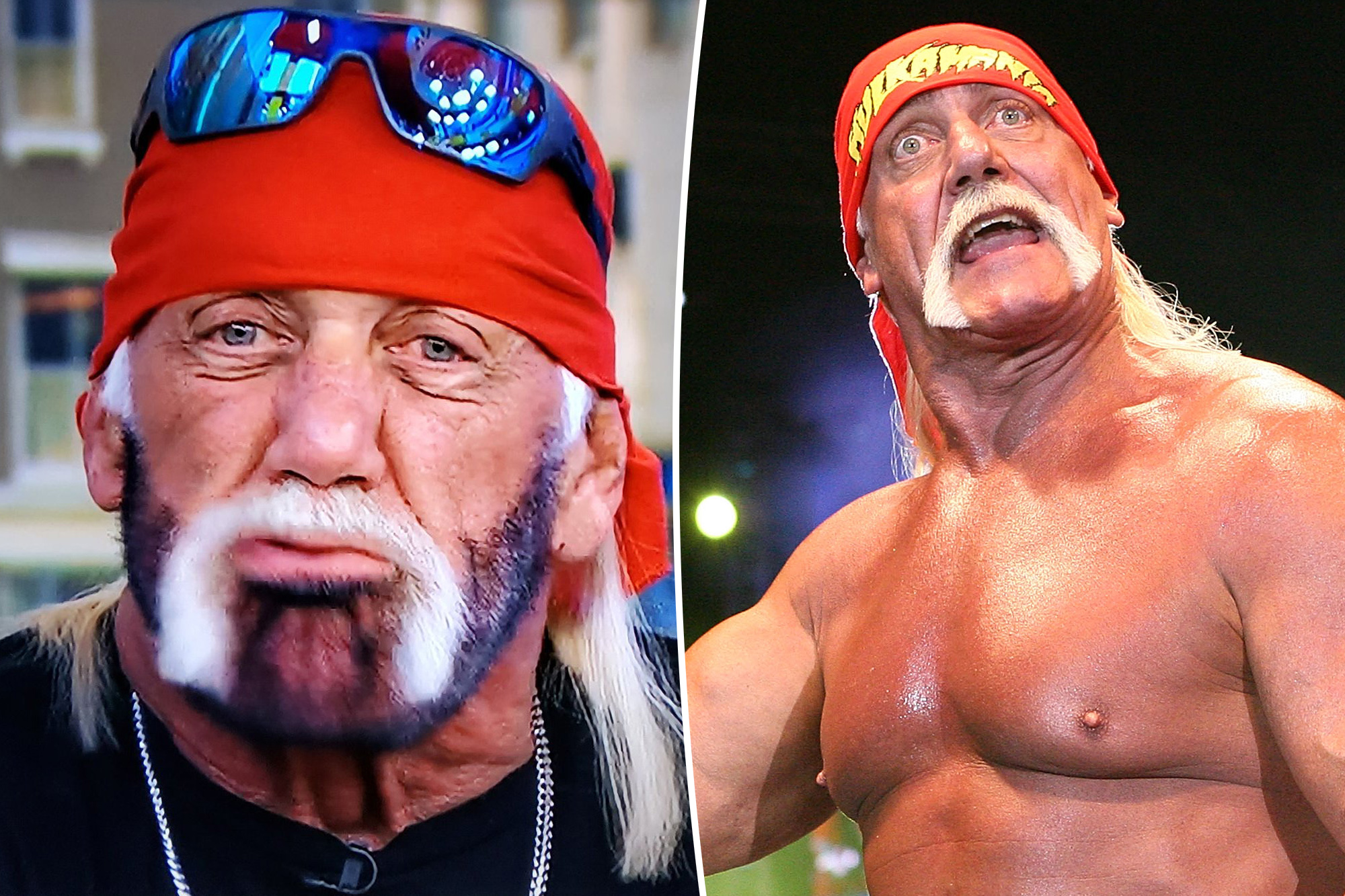 Hulk Hogan gets neck surgery after sparking concern with dramatic new look
