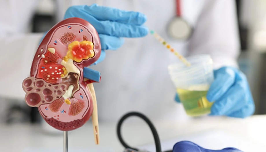 Kidney Health: Test to detect kidney problems, know how much it costs..