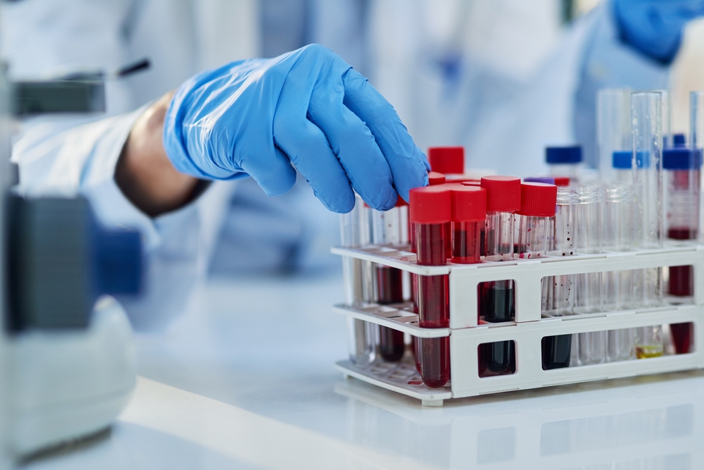 New study: Blood test can predict the effectiveness of breast cancer ...