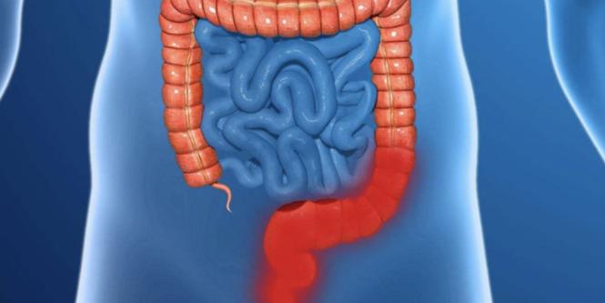 Colon limpio y saludable: 5 consejos caseros que realmente funcionan