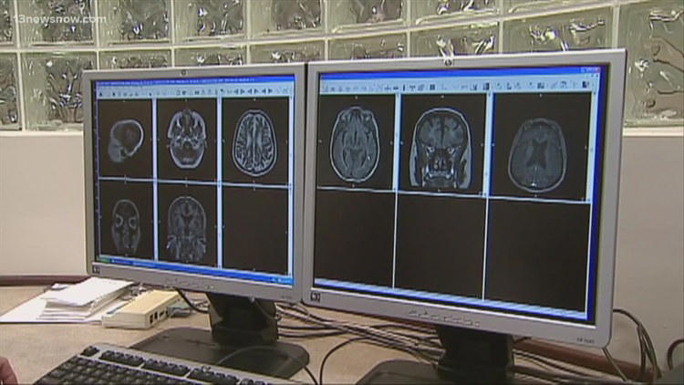 Stroke cases on the rise among children and adults, say Sentara Health ...