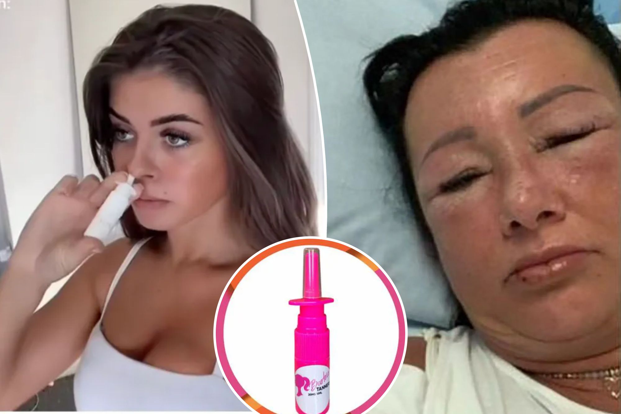 Viral ‘Barbie drug’ that can help you tan can cause brain swelling ...