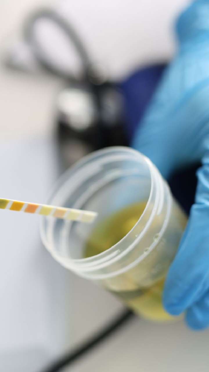 6 Warning Signs Of Pus In Your Urine You Shouldn’t Ignore!