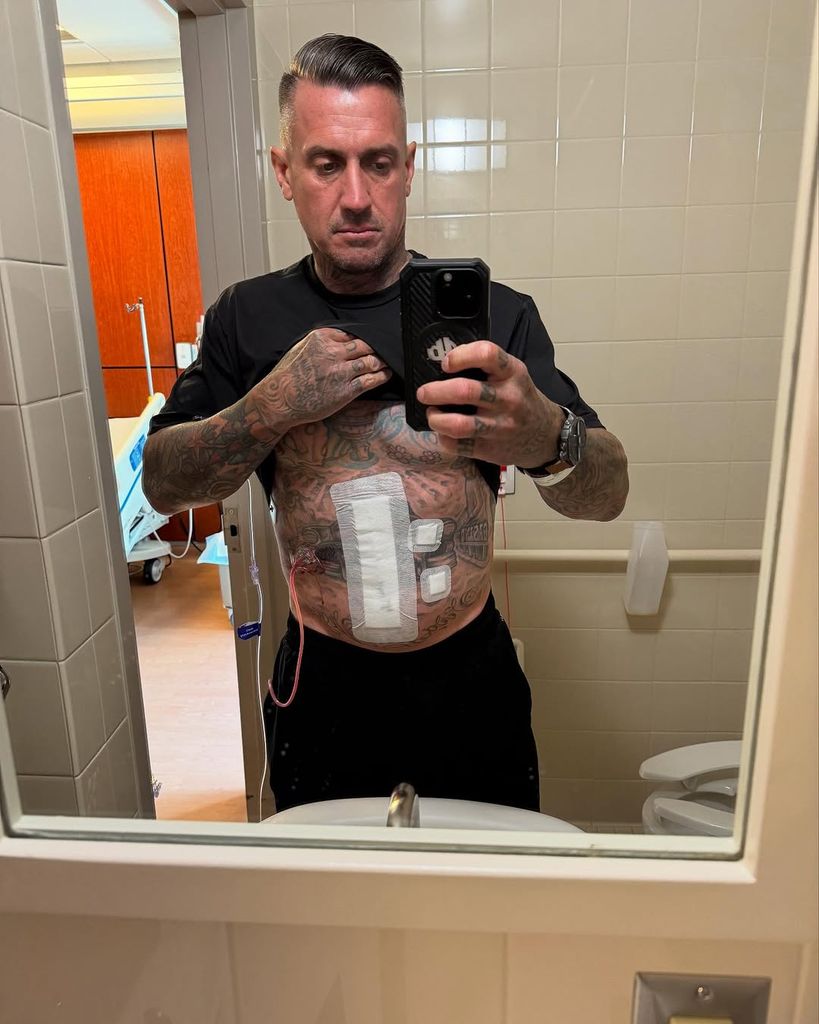 Pink's husband Carey Hart reveals 'pretty nasty' injury as he ...