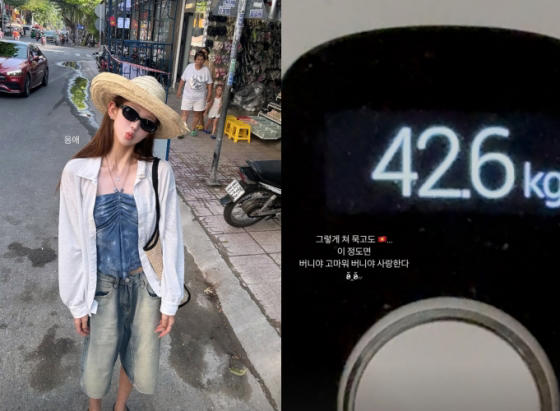 42kg 최준희, 얼굴 붓기 빼는 수술 어땠길래? "운동을 못해서"