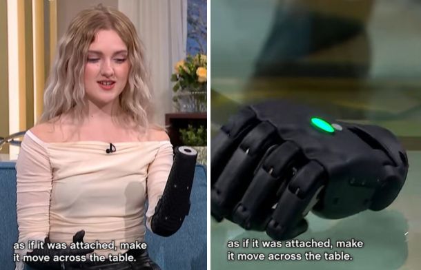 Amazing Technology: Woman Becomes The First Person To Receive Wireless ...