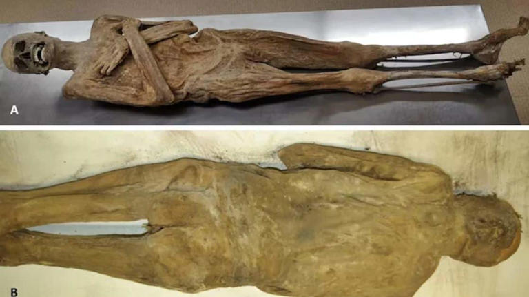 279-Year-Old Austrian Mummy Reveals Mysterious Embalming Method Never ...
