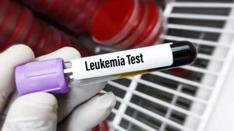 Life-Saving Leukemia Breakthrough? New Test Detects Relapse Before Symptoms