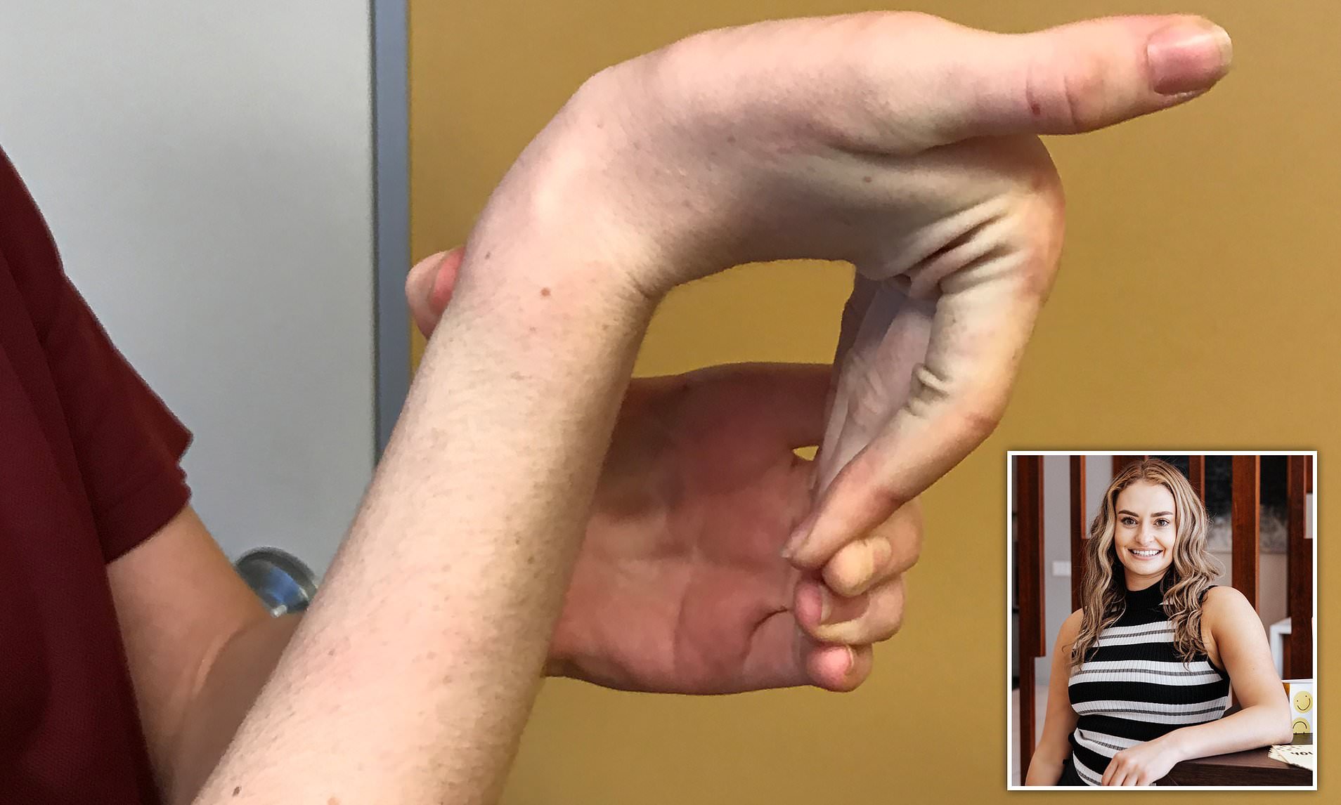 Simple finger flexibility test that reveals risk of terrifying lung disease