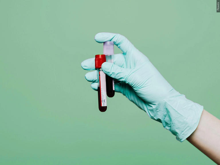 MDHHS finalizes rules for child blood lead testing in state