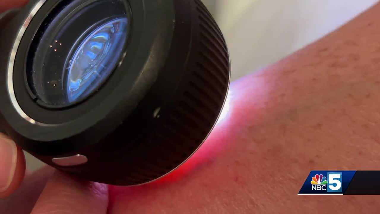 Free screenings focus on detecting and preventing skin cancer