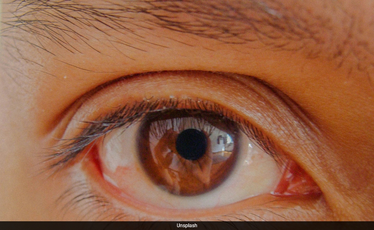 Bulging Eye Disease Cases Rising Among Women Over 40: Report