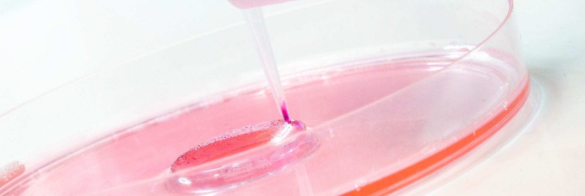 3D Printing Collagen Scaffolds with Perfusable Systems for Tissue ...