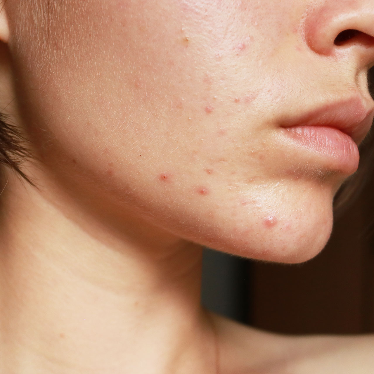 The 4 Warning Signs Your Diet Is Behind Your 'Skin Issues'