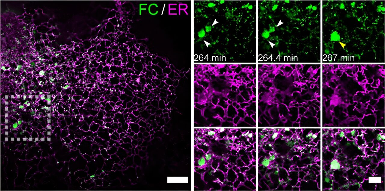 Phase separation by fusion protein FC reveals new mechanism for tumor ...