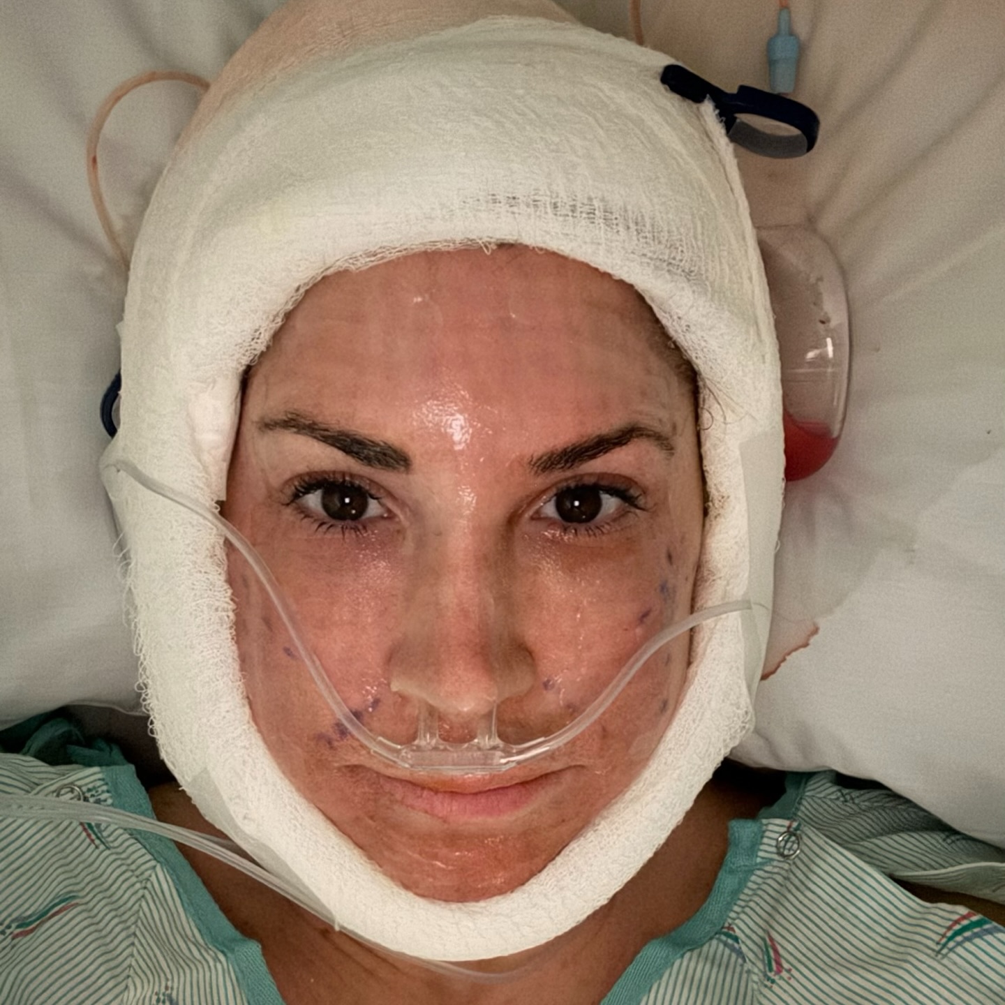 ‘RHONJ’ alum Jacqueline Laurita posts jarring video after facelift and ...