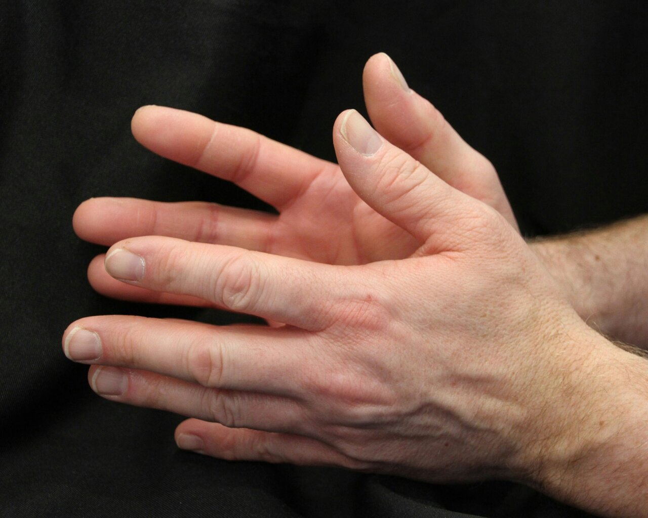 Whats The Difference Between Osteoarthritis And Rheumatoid Arthritis 5798